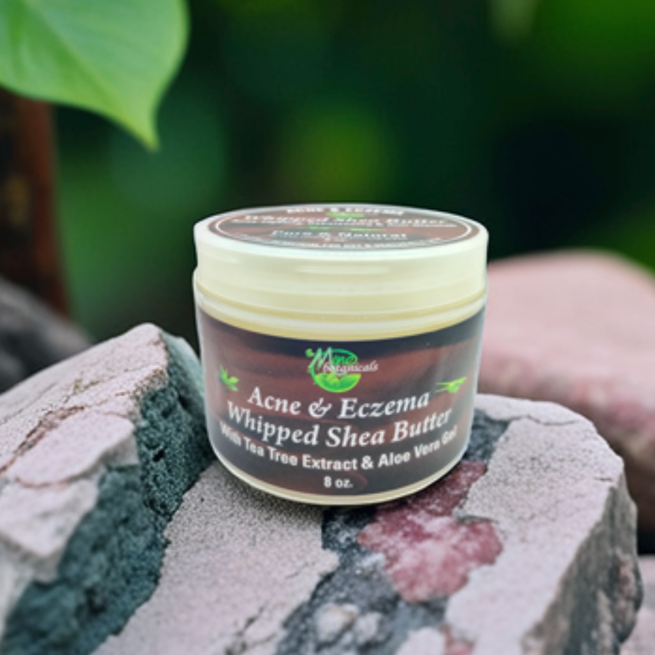 Acne & Eczema Whipped Shea Butter – Mine Botanicals
