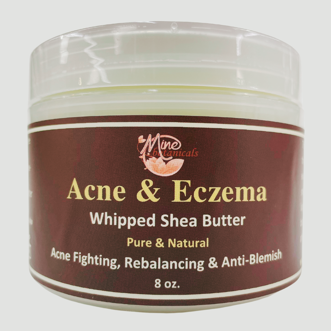 Acne & Eczema Whipped Shea Butter – Mine Botanicals